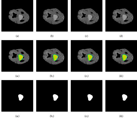 A − D Segmentation Using Qde Qisnet A1 − D1 Post Processed With