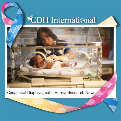 Cdh International A Global Initiative To Stop Congenital