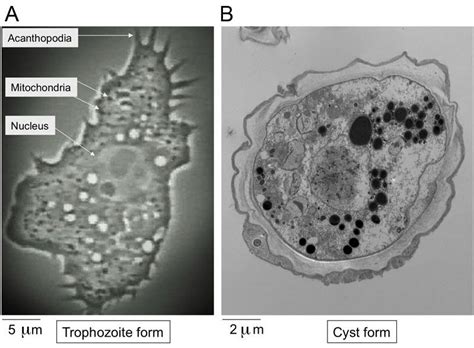 Acanthamoeba Cyst Morphology