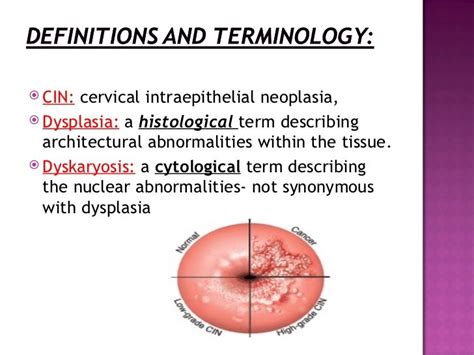 Gynaecology Cin Dr Mraim