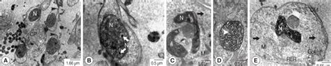 Transmission Electron Micrographs Of An Adult P Heterotremus Testis