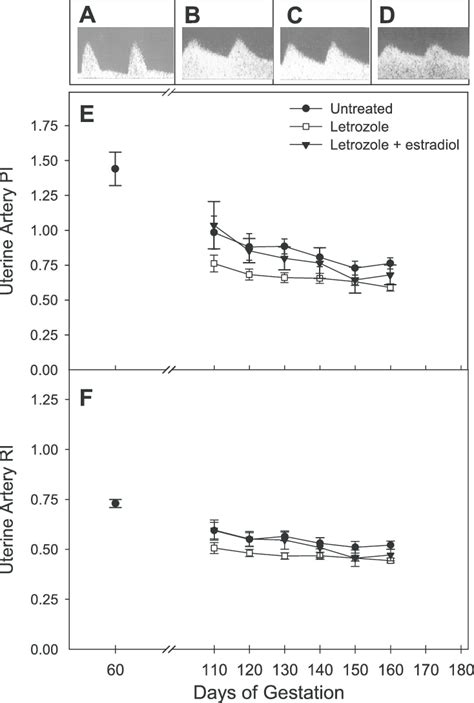 Representative Uterine Artery Doppler Flow Waveforms Assessed By Color