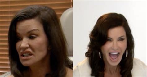 Botched Before And After Janice Dickinson Fixes Her 30 Year Old Breast