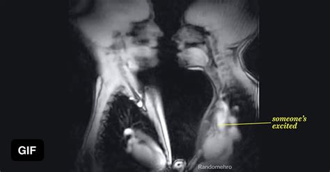 Sex In An Mri Scanner 9gag