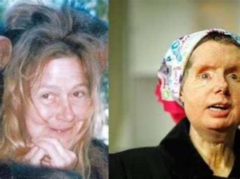 La Terrible Historia De Charla Nash La Mujer A La Que Un Chimpancé Le
