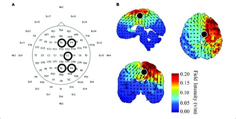 High Definition Hd Transcranial Direct Current Application And