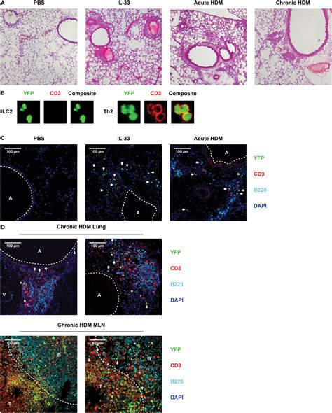 Frontiers Group 2 Innate Lymphoid Cells Exhibit A Dynamic Phenotype