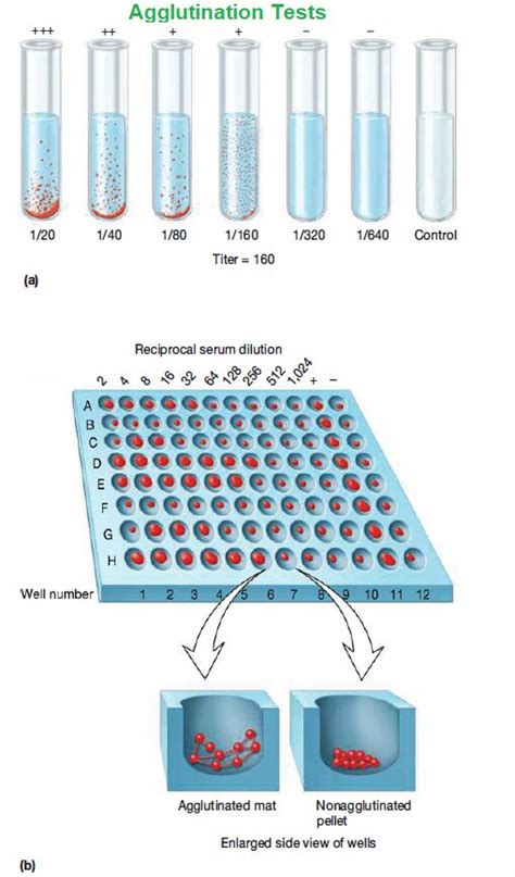 Agglutination Reaction Definition Uses And Application Microbiology