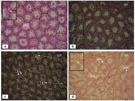 Light Micrographs Of Testicular Sections Stained With Hematoxylin And