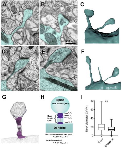 Figures And Data In Ultrastructural Comparison Of Dendritic Spine