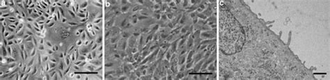 Morphology Of Conditionally Immortalized Proximal Tubular Epithelial