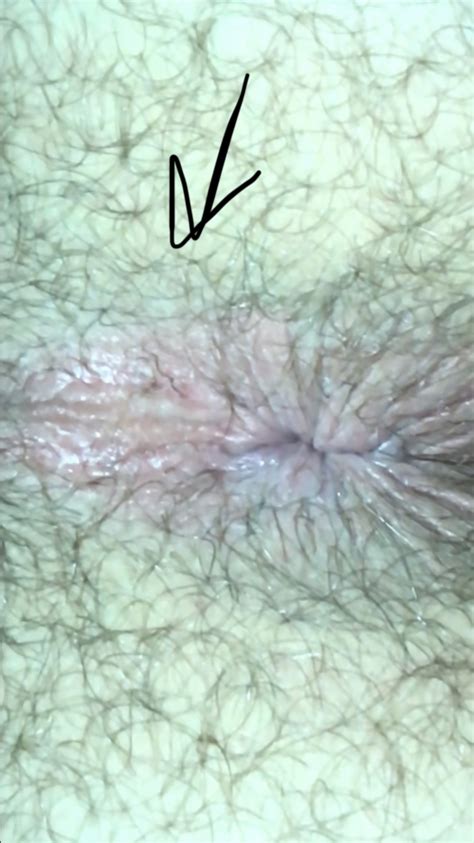 does anybody know what is this should i be worried