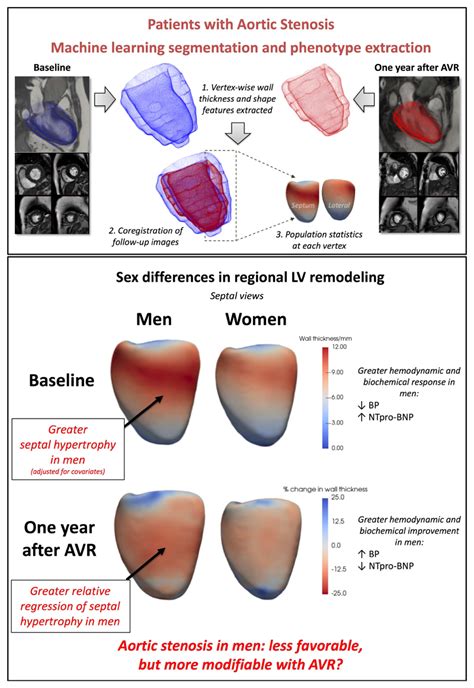 sex and regional differences in myocardial plasticity in aortic