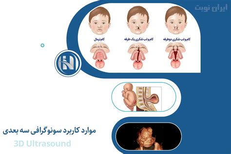 هر آنچه باید در مورد سونوگرافی سه بعدی بدانید