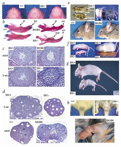 Insertion Of Inhbb Into The Inhba Locus Rescues The Inhba Null