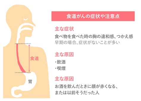 食道がん 緑区・天白のさくら医院 消化器内科・胃腸科・健康診断