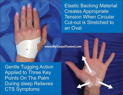 Tennis And Carpal Tunnel Prevention And Natural Treatment