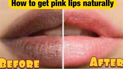 How To Get Pink Lips Pink Lips Permanently Pink Lips Before And