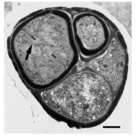 3 Electron Micrograph Of Ultrathin Section Of A Cell Aggregate Of