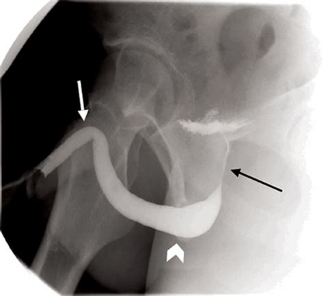 Male Urethrograms Urology News