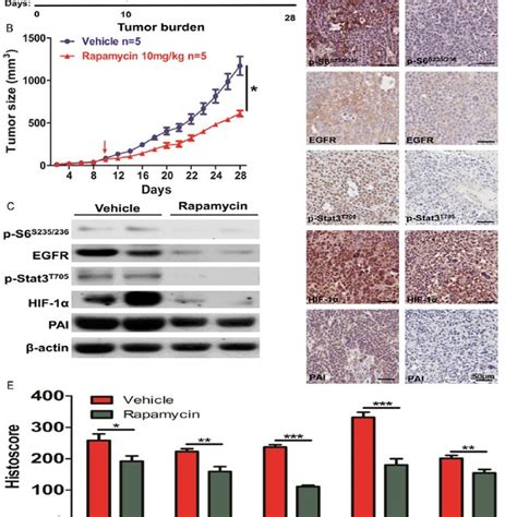 Overexpression Of P S6 S235 Egfr P Stat3 T705 Hif 1α Pai Correlated