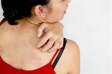 10 Signs Of Strep Throat Facty Health