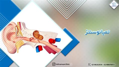 علائم عفونت گوش 29 تا از نشانه‌های چرکی شدن گوش چیست؟