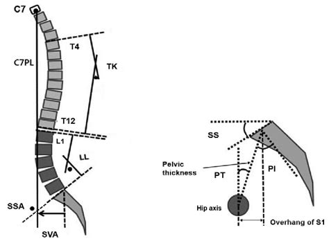 Figure 2 From From The Spinopelvic Parameters To Global Alignment And