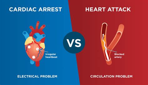 Difference Between Heart Attack And Cardiac Arrest Nigeria News