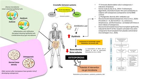 Iddf2020 Abs 0115 A Moulding Game The Role Of Gut Microbiome In