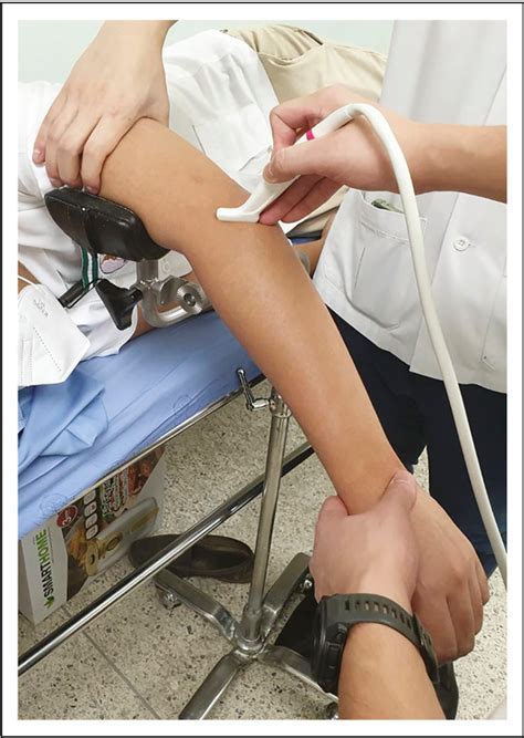 Figure 1 From The Sonographic Posterolateral Rotatory Stress Test