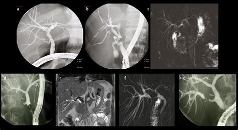 mistakes in endoscopy and how to avoid them ueg united european