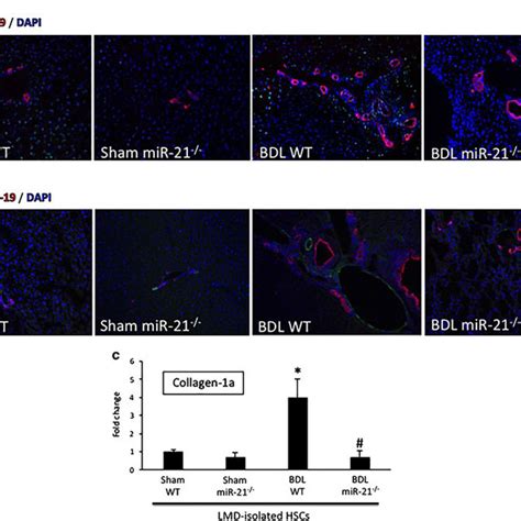 Evaluation Of Hepatic Stellate Cell Hsc Activation And Fibrotic
