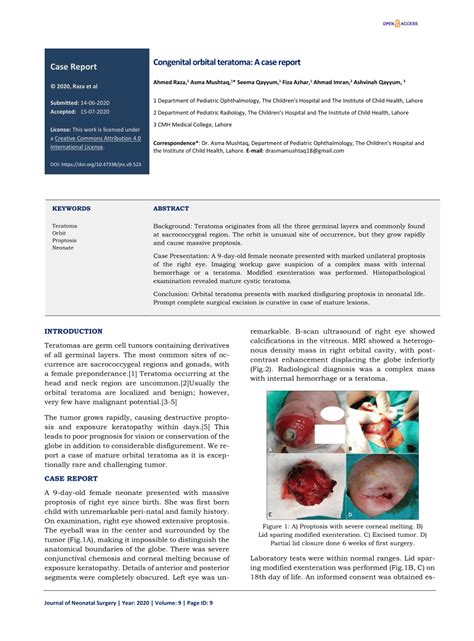 Pdf Congenital Orbital Teratoma A Case Report