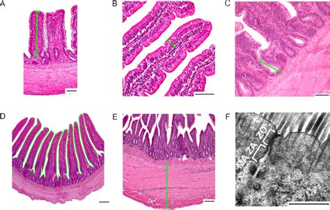 Morphometric Measurements A Ileal Villus Height B Jejunal