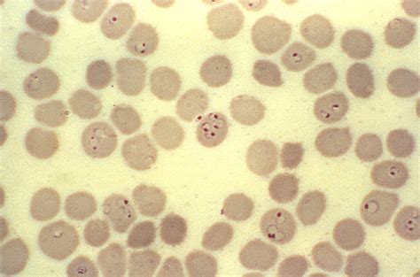 Free Picture Micrograph Ring Form Plasmodium Falciparum Trophozoites
