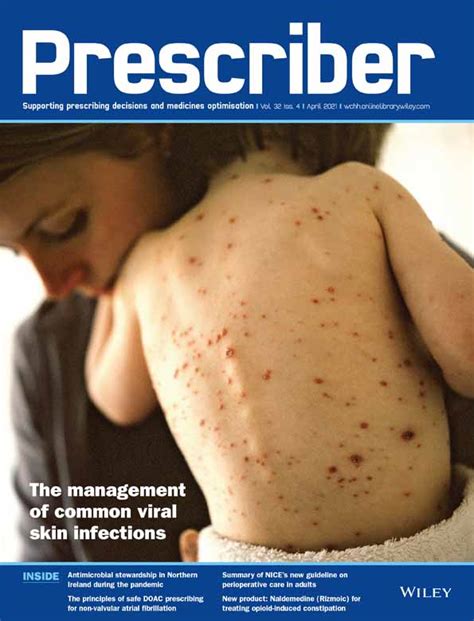 Diagnosis And Management Of Common Viral Skin Infections Thandi