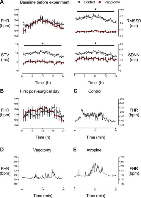 Baseline Fetal Heart Rate Fhr And Fhr Variability Patterns A The