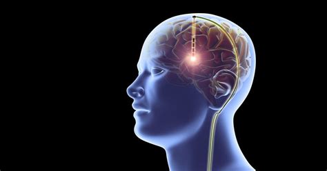 آیا تحریک الکتریکی مغز واقعا اثر دارد؟ کلینیک سلامت مغز دانا