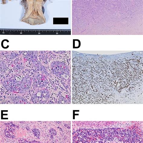 Figure4 Macroscopic And Histopathological Examinations A A