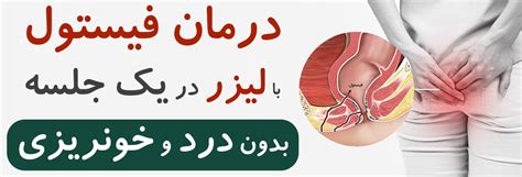 فیستول و آبسه مقعدی چیست؟ علائم، نشانه ها و آزمایشات کلینیک پایتخت
