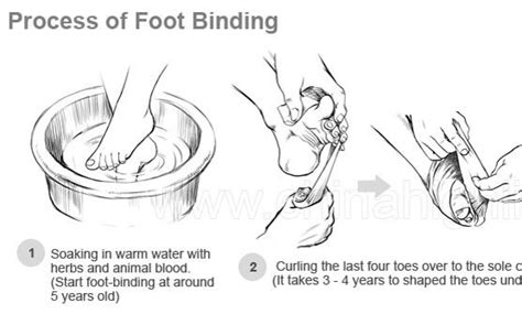 Foot Binding X Ray