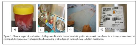 Clinical Experimental Dermatology Allogenous Biostatic