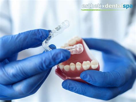 How Does Invisalign Work For Crowded Teeth In Adults
