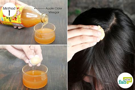Can I Use Apple Cider Vinegar On My Scalp Apple Poster