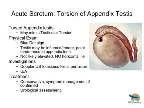 Scrotal Masses And Testicular Tumors