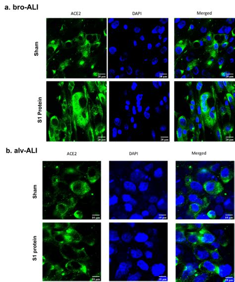 Confocal Microscopy Of Angiotensin Converting Enzyme 2 Ace2