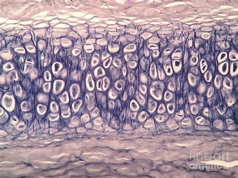 Human Cartilage Photograph By Choksawatdikorn Science Photo Library