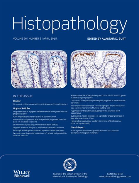 Histology Of Microscopic Colitis—review With A Practical Approach For