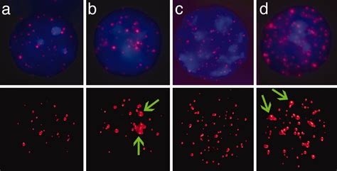 C Myc Induces Chromosomal Rearrangements Through Telomere And